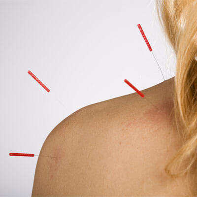 Goodlettsville Chiropractor Chiropractic Goodlettsville Tennessee ...